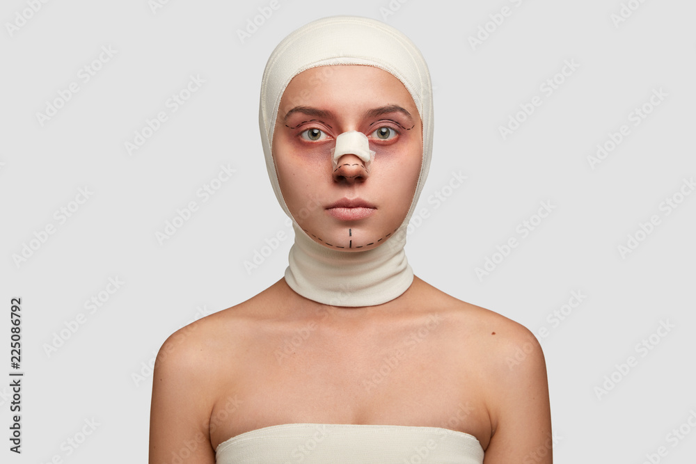 Postoperative syndrom. Indoor shot of woman had plastic surgery, has ...