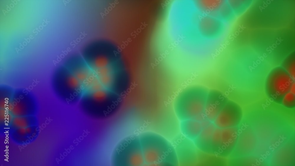 Cross section of the tissue in the microscopic view, cancer of a human ...