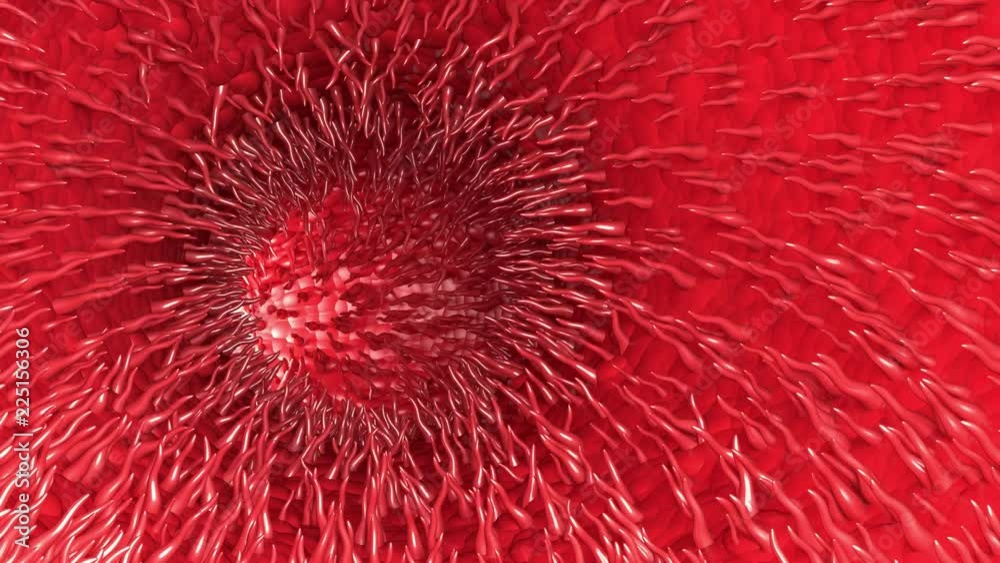 Human internal organs, intestines, medical operation. 3d animation ...