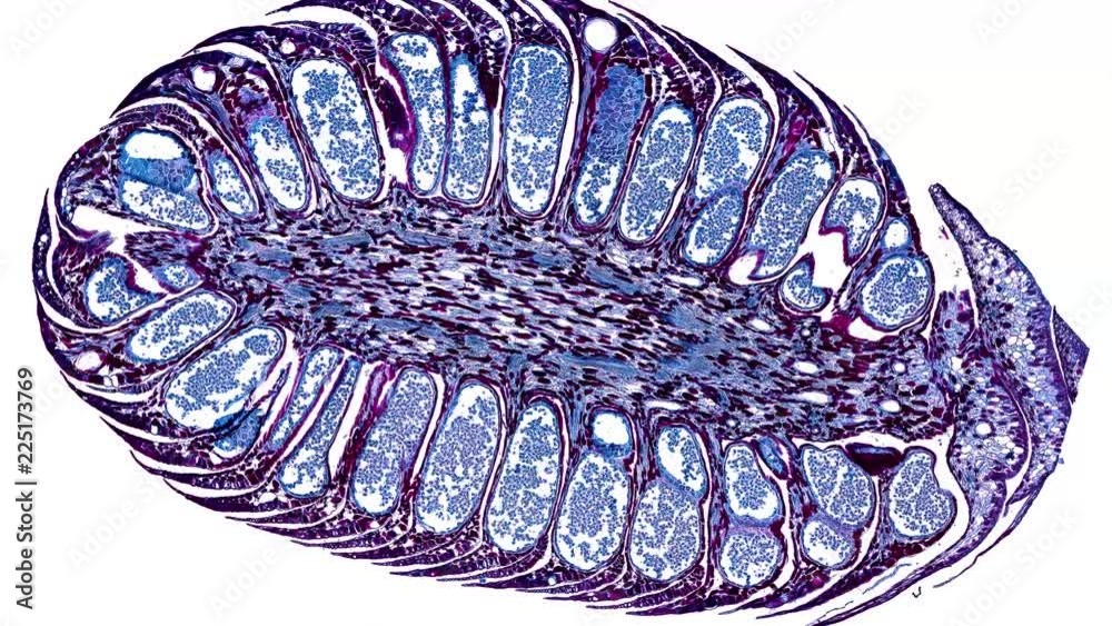 pine male cone - cross section cut under the microscope – microscopic ...