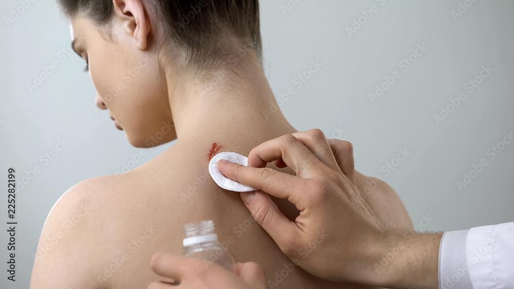 Doctor treating wound on female back with antiseptic, injury healing ...