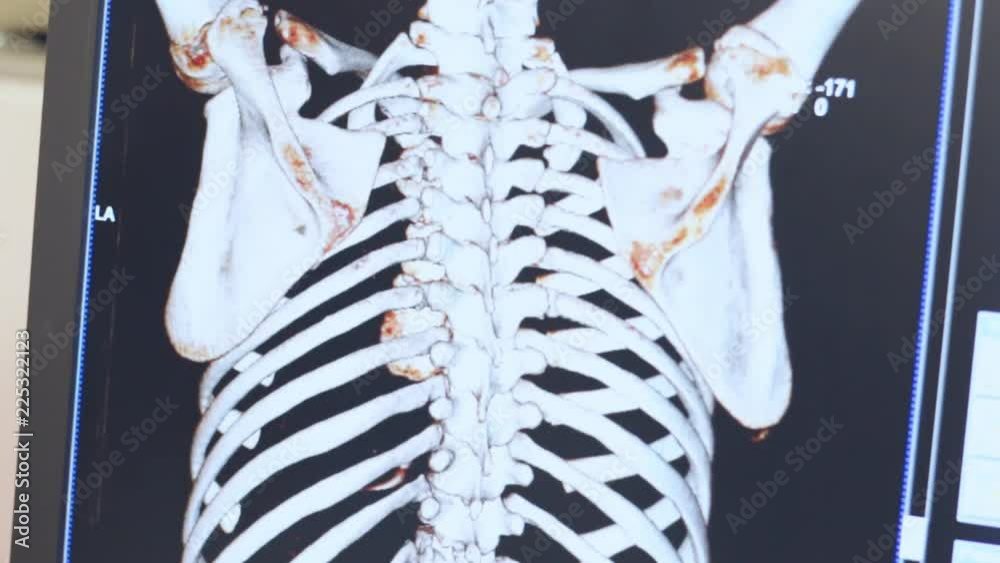 Magnetic resonance imaging of human skeleton on display. Professional ...