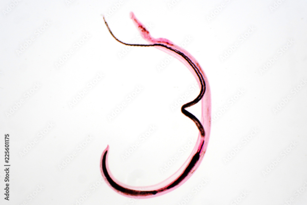 whipworm (Trichuris trichiura) is parasitic helminthic nematode ...