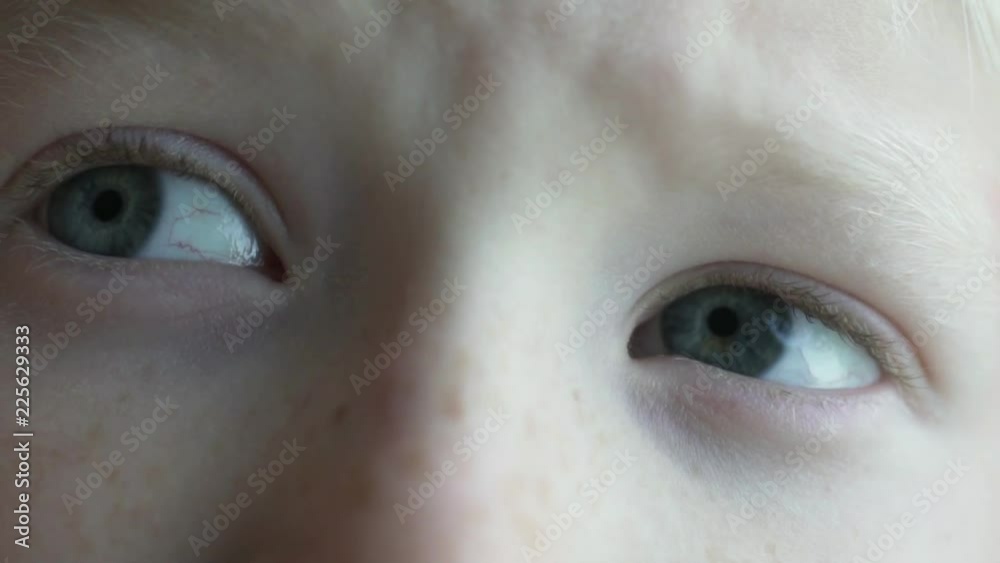 Macro shooting. Eyes of an albino (blond) boy close-up. Two eyes, white ...