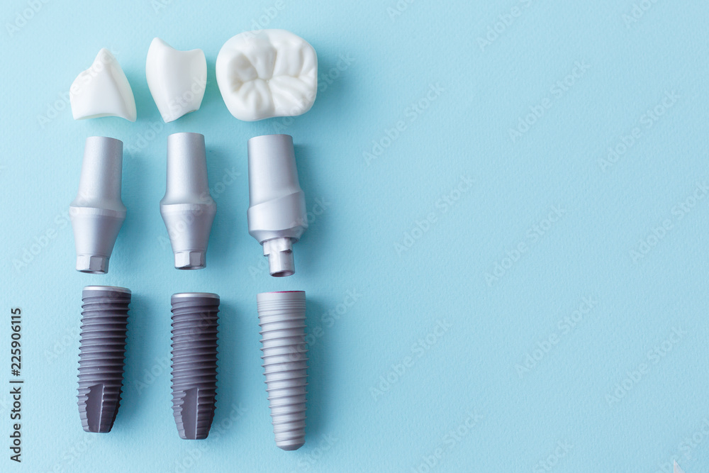 This model shows that teeth have been capped and the stainless pin in ...