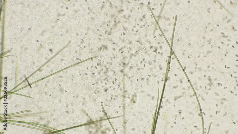 colony of bacteria spirochetes under a microscope Stock 비디오 | Adobe Stock