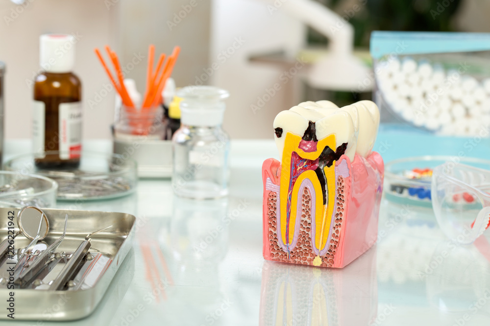 tooth anatomy (vital tooth, structure, bone, ligament) Stock Photo ...