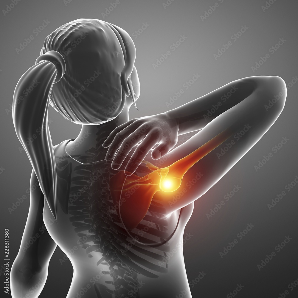 Woman with a painful shoulder, illustration Stock Photo | Adobe Stock