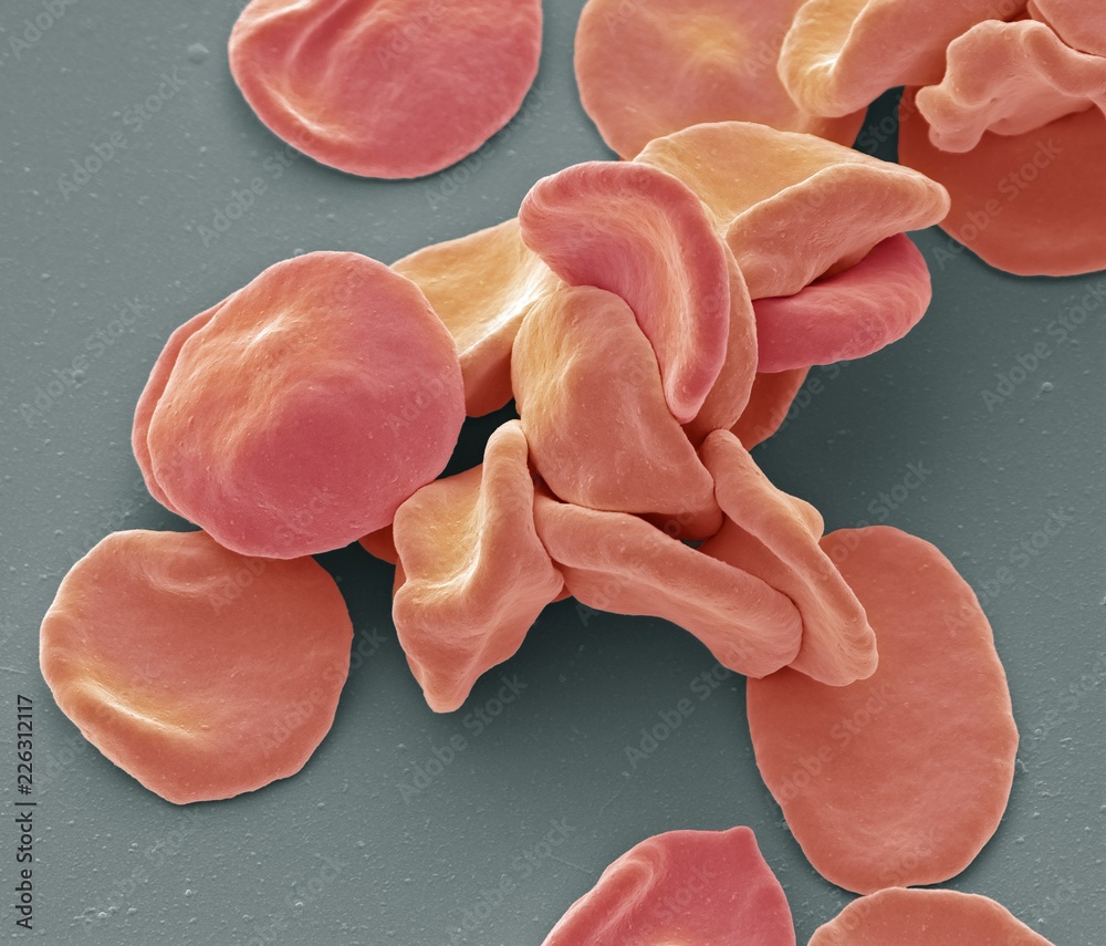Red blood cells, SEM Stock Photo | Adobe Stock