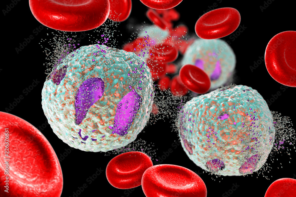 Destruction of lymphoblasts. Conceptual 3D illustration of treatment of ...