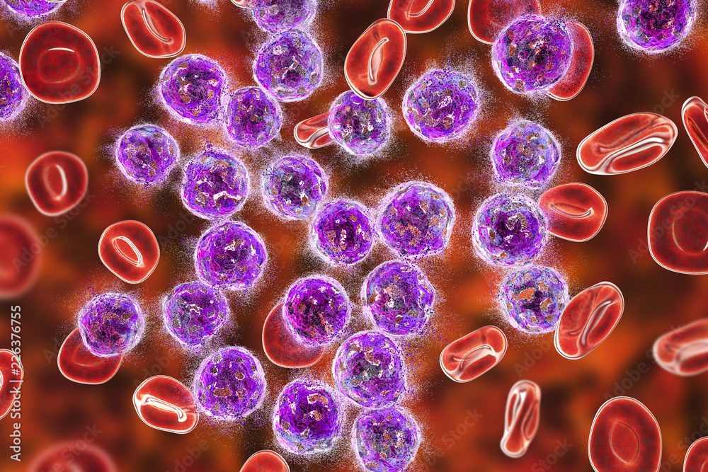 Destruction of lymphoblasts. Conceptual 3D illustration of treatment of ...