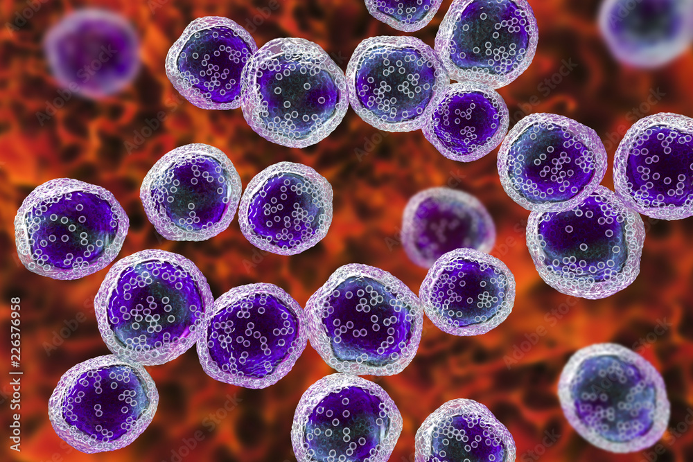 Burkitt's lymphoma cells, a cancer of the lymphatic system, monoclonal ...