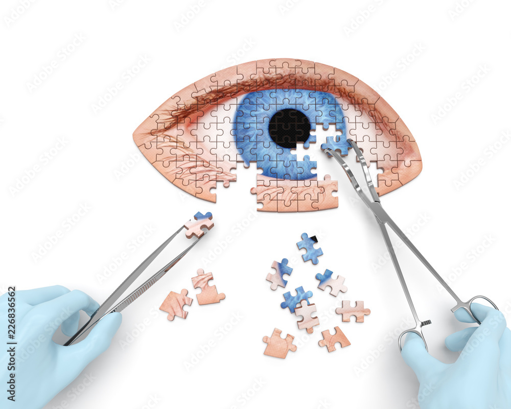 Eye operation (vision correction) puzzle concept: hands of surgeon with ...