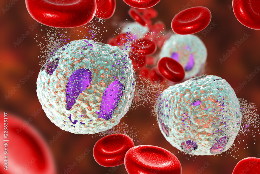 Destruction of lymphoblasts. Conceptual 3D illustration of treatment of ...