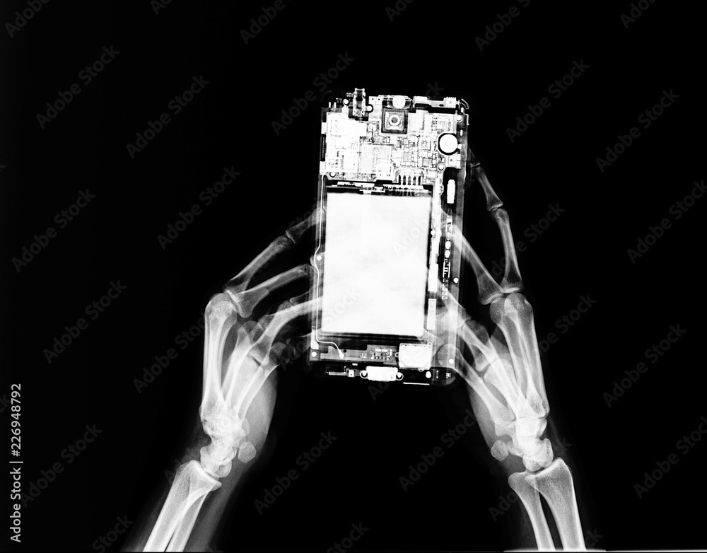 hands skeleton and mobile phone on x-ray Stock Photo | Adobe Stock