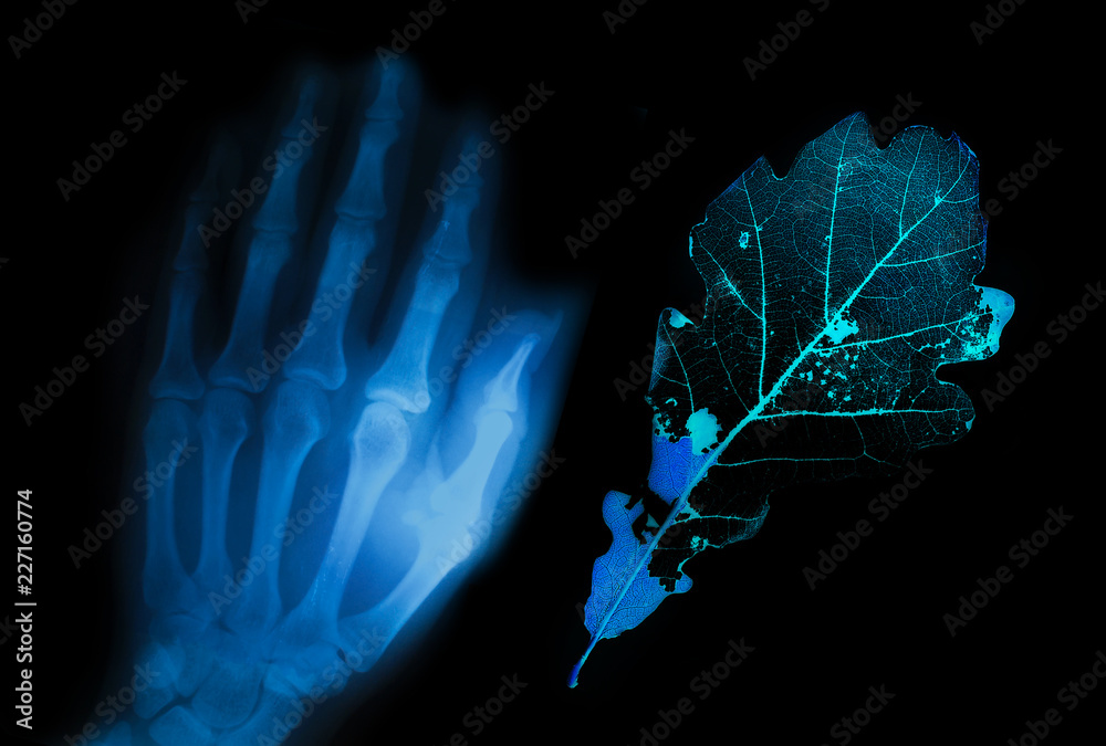 x-ray human hand and leaf of a tree in comparison. The concept of ...