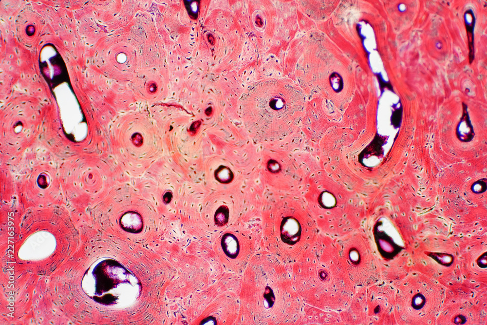 Histology of human compact bone tissue under microscope view for ...
