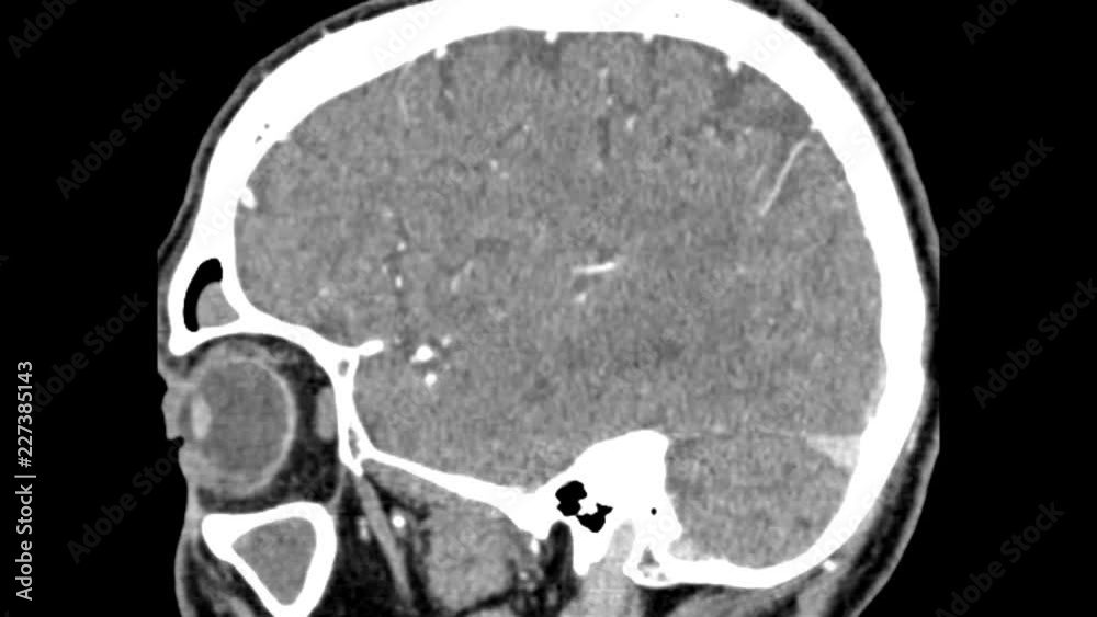 Angiography and magnetic resonance imaging live imaging scans from the ...