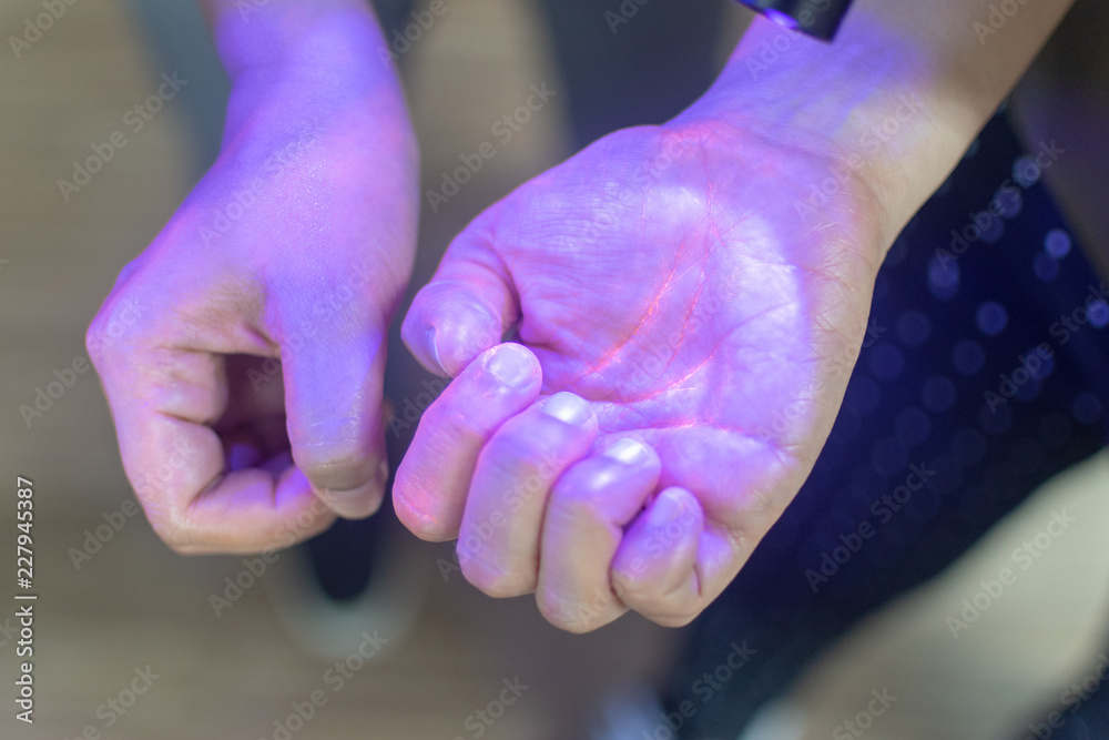 Hands under black UV light to detect glow in the dark germs around ...