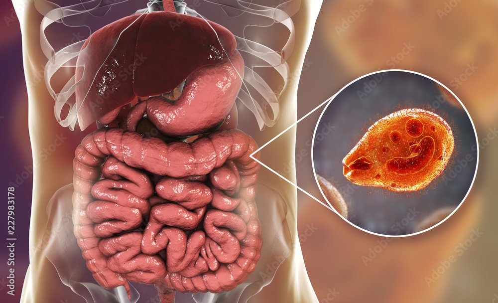 Balantidium coli protozoan in large intestine, 3D illustration ...