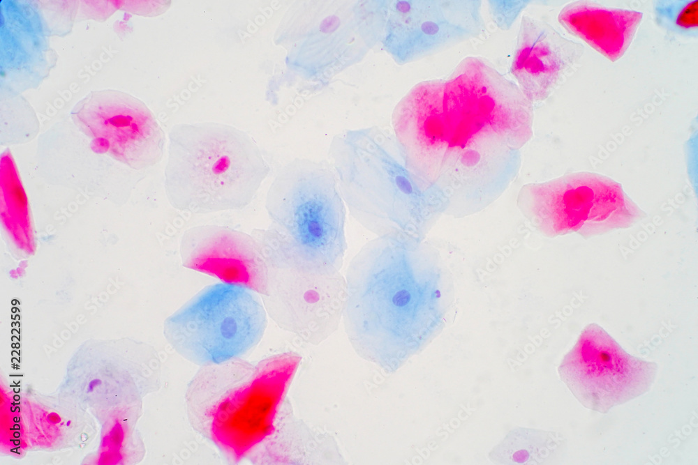 Squamous epithelial cells under microscope view for education histology ...