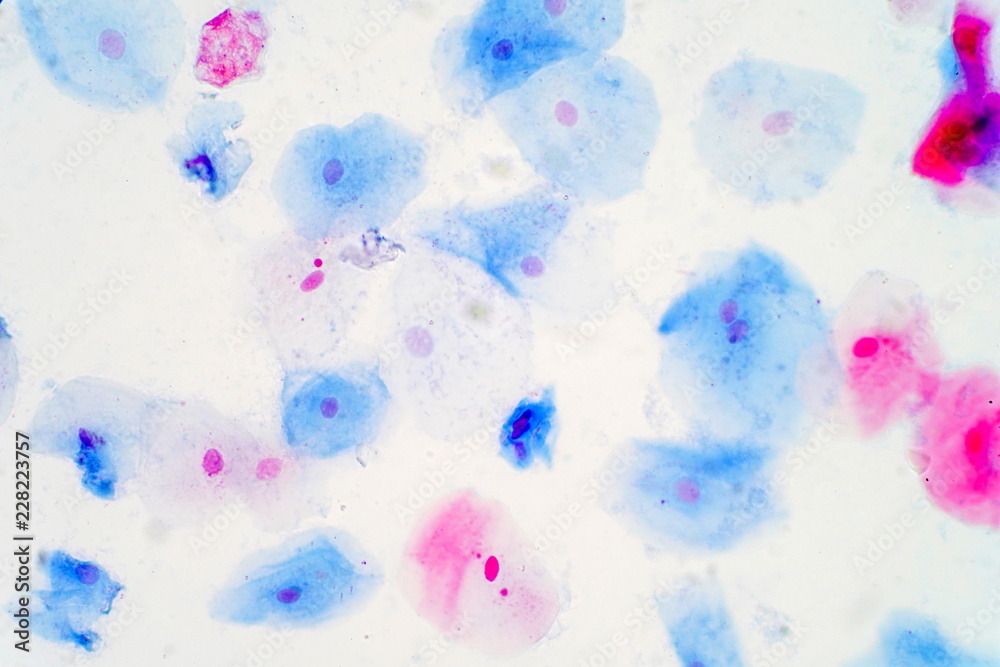 Squamous epithelial cells under microscope view for education histology ...