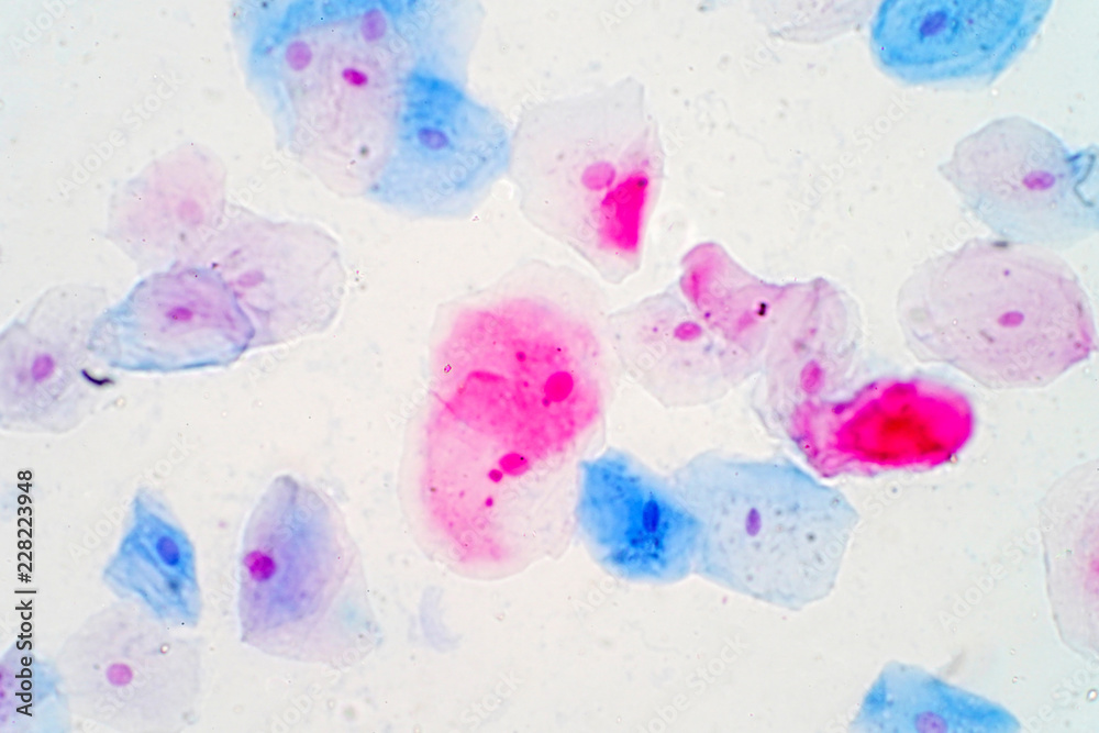 Squamous Epithelial Cells Under Microscope