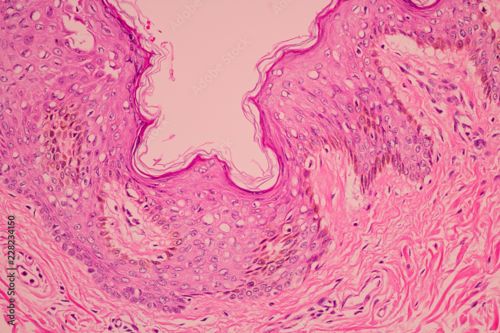View in microscopic of pathology cross section tissue ductal cell ...