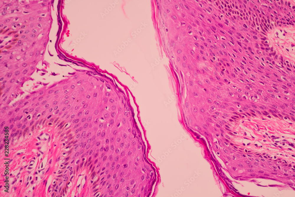 View in microscopic of pathology cross section tissue ductal cell ...