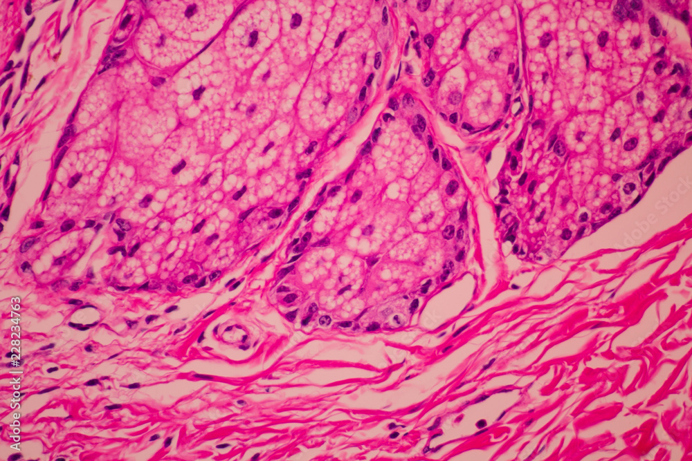 View in microscopic of pathology cross section tissue ductal cell ...