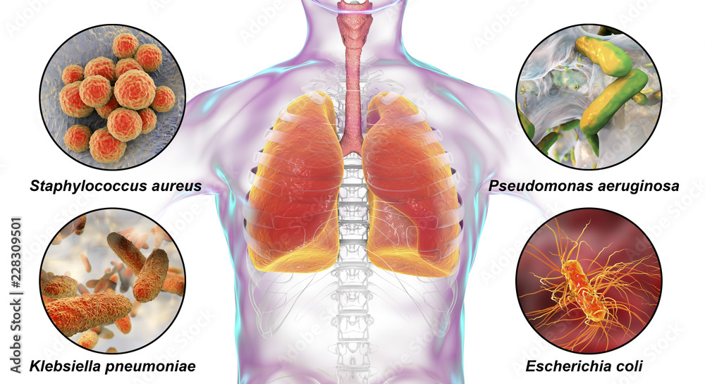 Human respiratory pathogens, bacteria that cause nosocomial pneumonia ...
