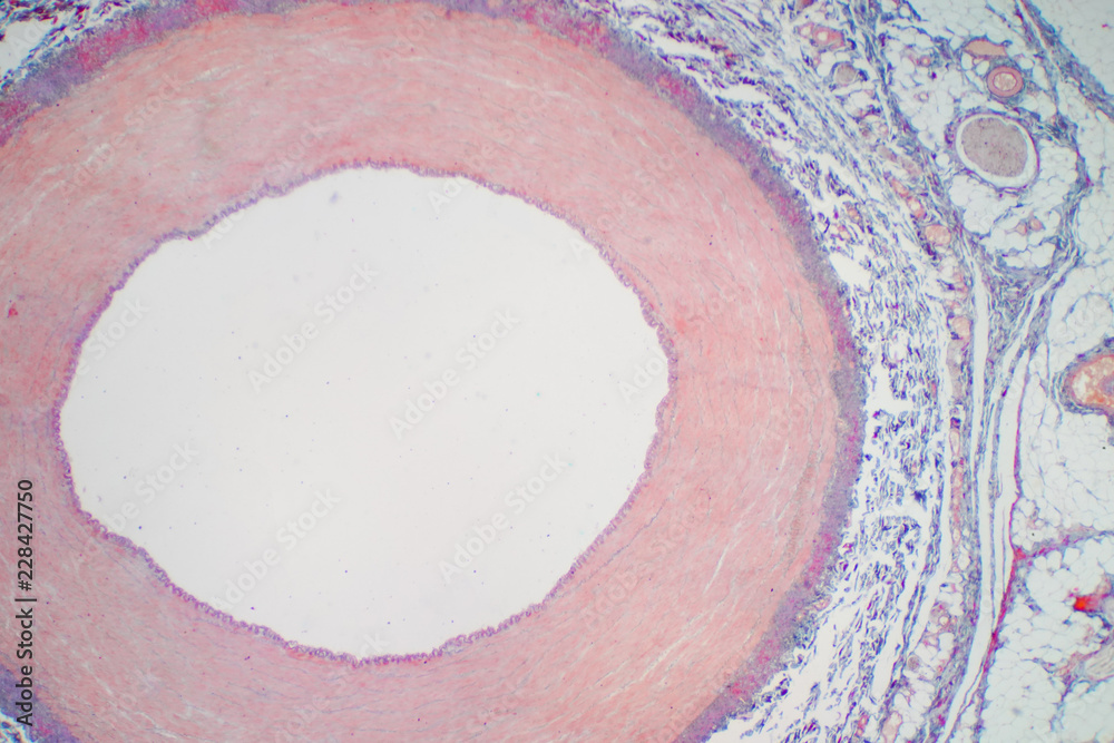 Artery blood vessel under microscope view for education histology ...