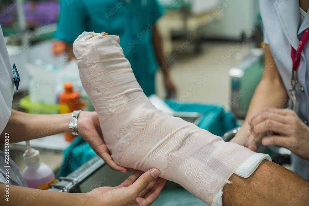 Patient with broken leg and splinted for treatment in the hospital ...