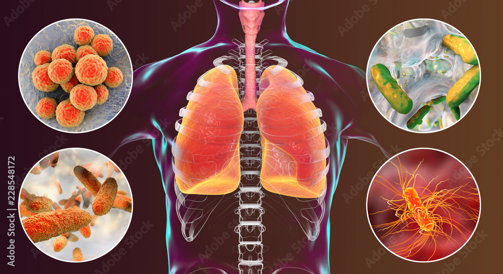 Human respiratory pathogens, bacteria that cause nosocomial pneumonia ... Human respiratory pathogens, bacteria that cause nosocomial pneumonia ...