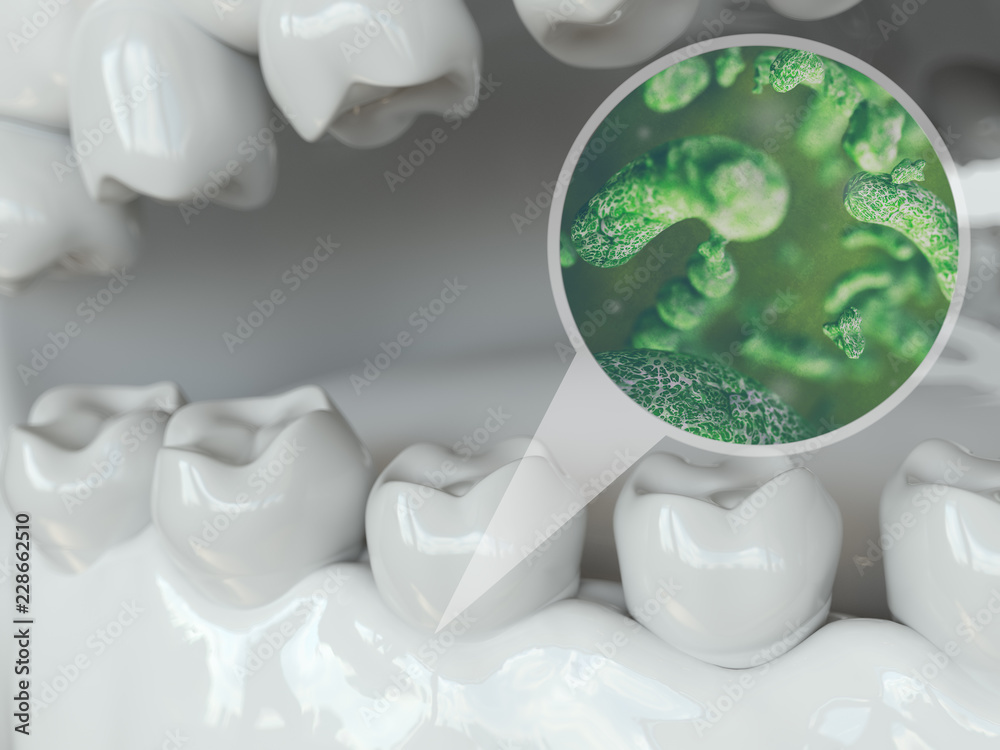 Bacteria and viruses around tooth 2 of 2 - 3D Rendering Stock ...