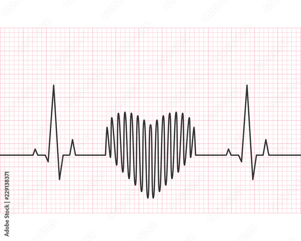 Heart rate line with grid in the background. Heartbeat, pulse and rythm ...