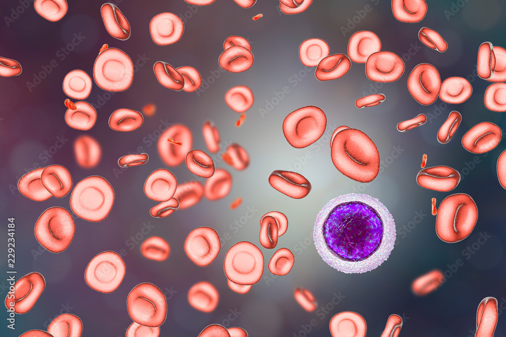 Iron deficiency anemia, 3D illustration showing small hypochromic red ...