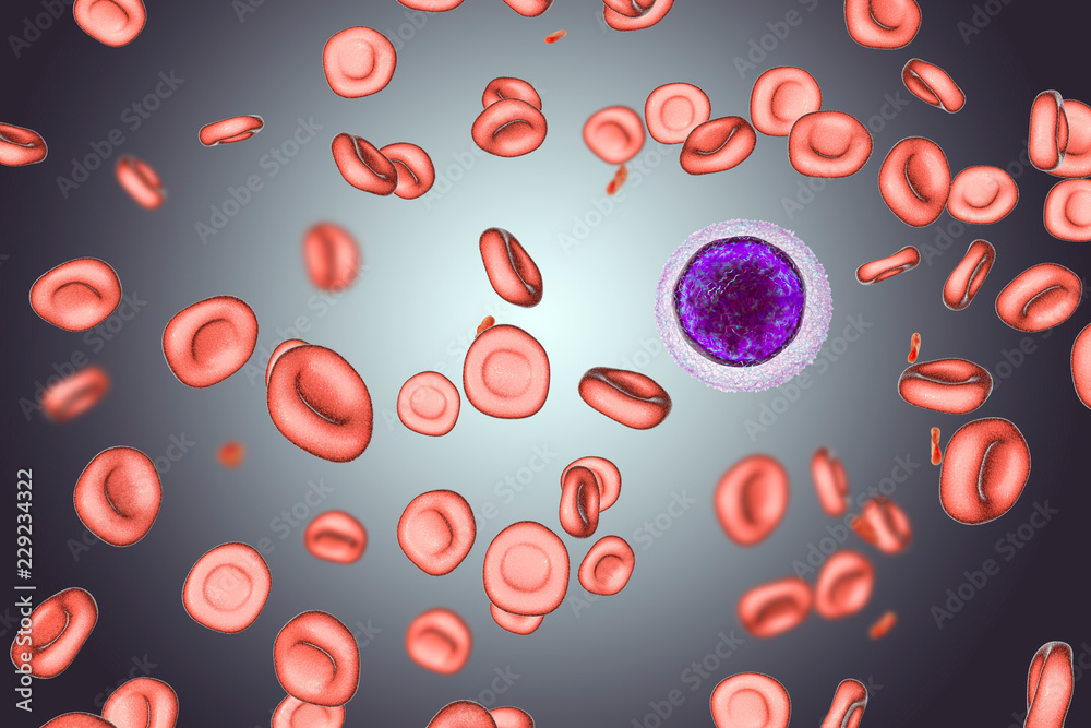 Iron deficiency anemia, 3D illustration showing small hypochromic red ...
