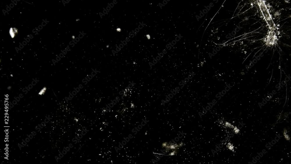 the movement of microorganisms on a black background, similar to the ...