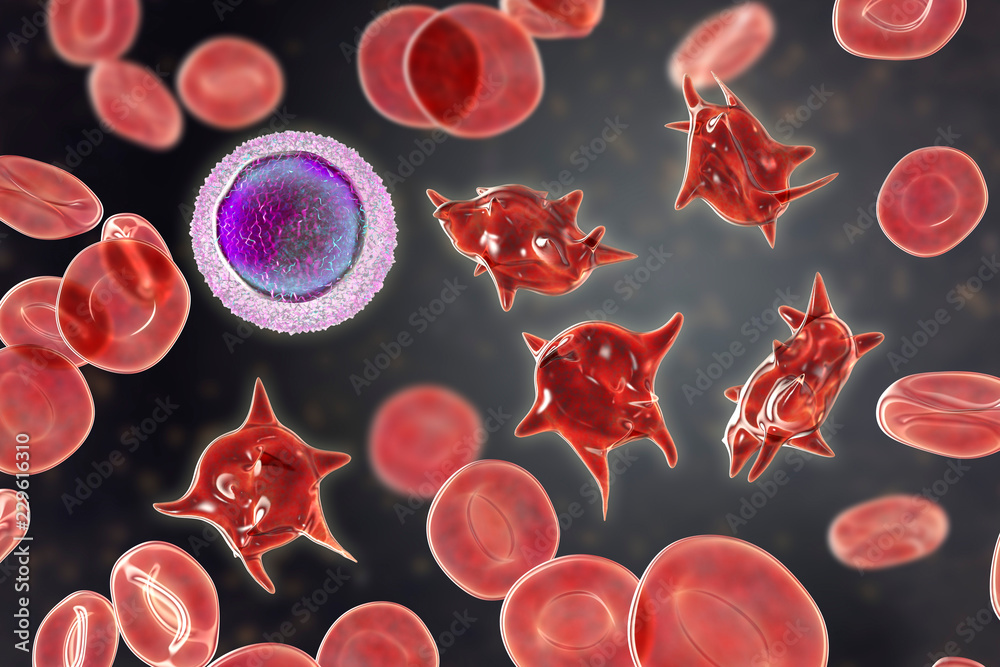 Acanthocytes, abnormal red blood cells with thorn-like projections, 3D ...