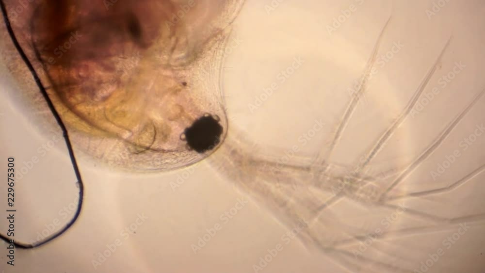 Internal anatomy of the water flea, Daphnia. Microscopic features such ...