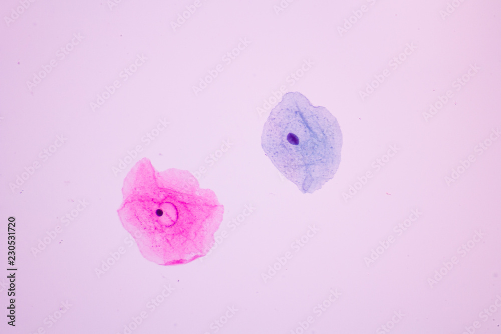 Normal squamous epithelial cells of cervical woman on white background ...
