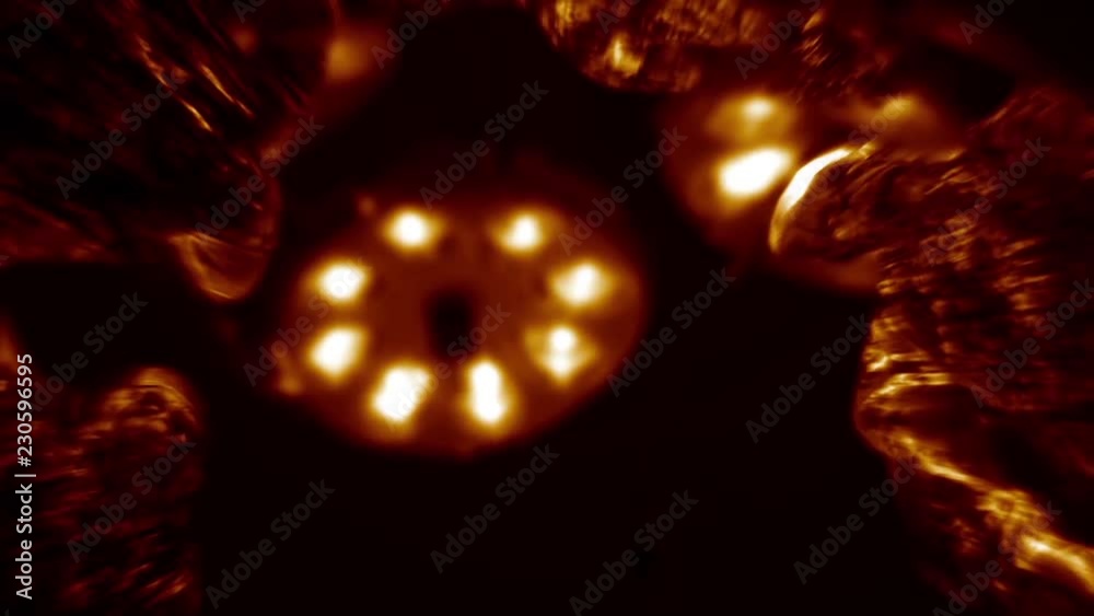 Zombie hospital. Doctors monsters attack patient lying on operating ...