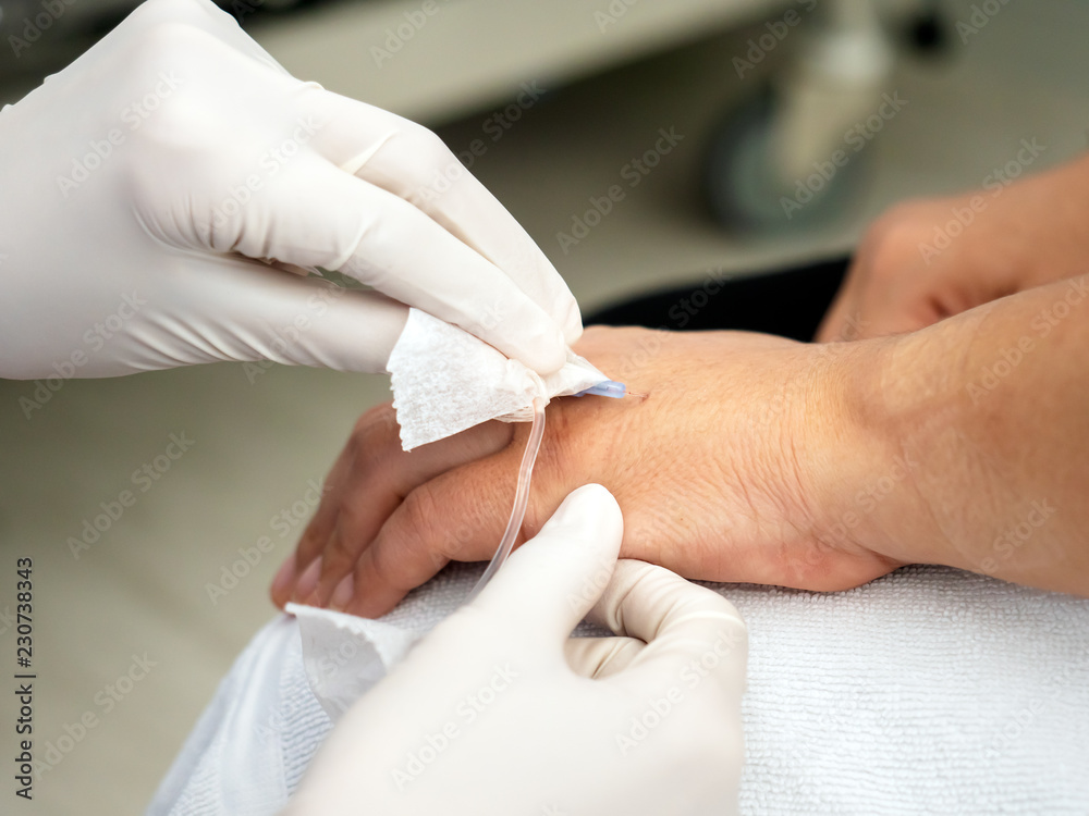 Nurse hands using medical and pull IV Catheter on patient hand for ...