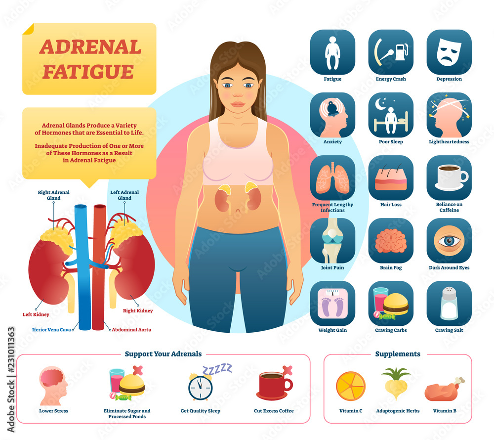 Adrenal fatigue vector illustration. List of glands disease symptoms ...