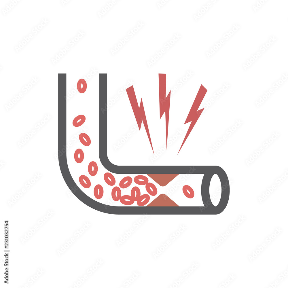 Thrombosis line icon. Vector sign for web graphics. Stock Vector ...