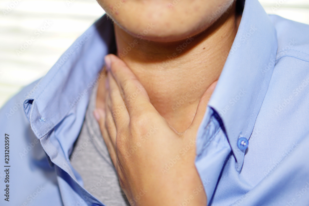 Asian lady woman patient have abnormal enlargement of thyroid gland ...