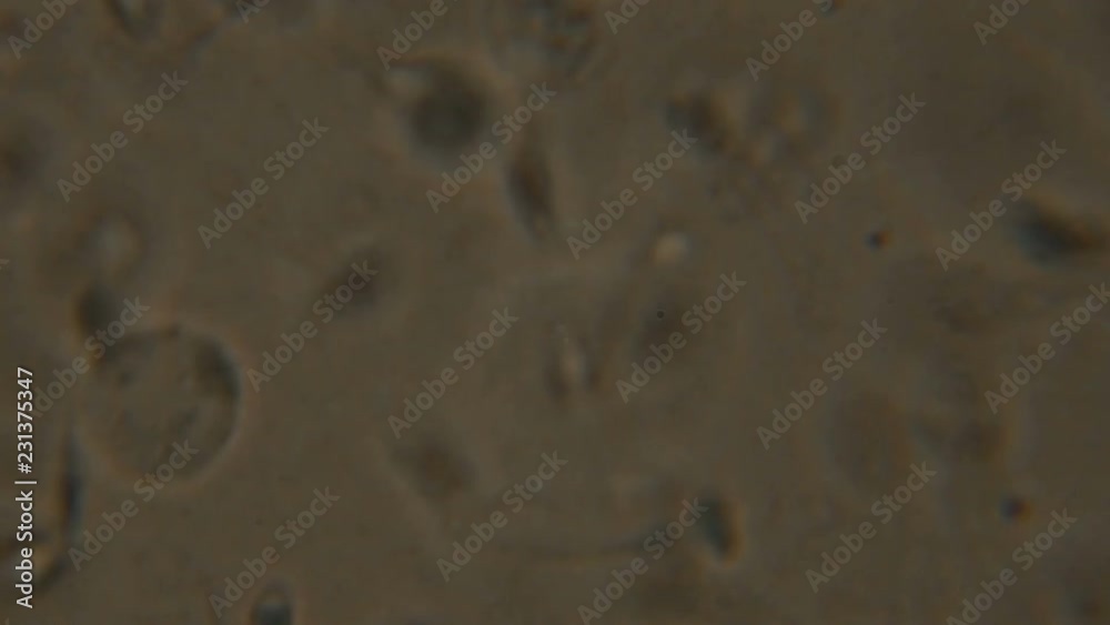 Sperm (spermatozoa) viewed under the microscope. Moving human sperm ...
