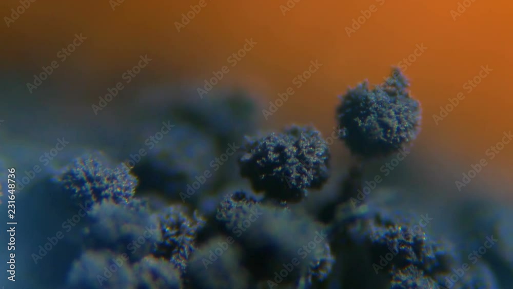 Black Mold taken from rotten bread , under a microscope. Colony of mold ...