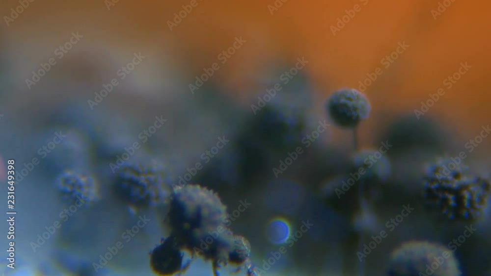 Black Mold taken from rotten bread , under a microscope. Colony of mold ...